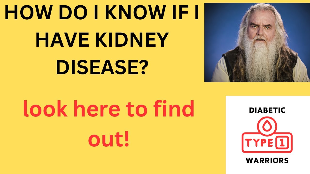 How Do I Know If I Have Kidney Disease Reducing The Risk Of Kidney how-do-i-know-if-i-have-kidney-disease-reducing-the-risk-of-kidney