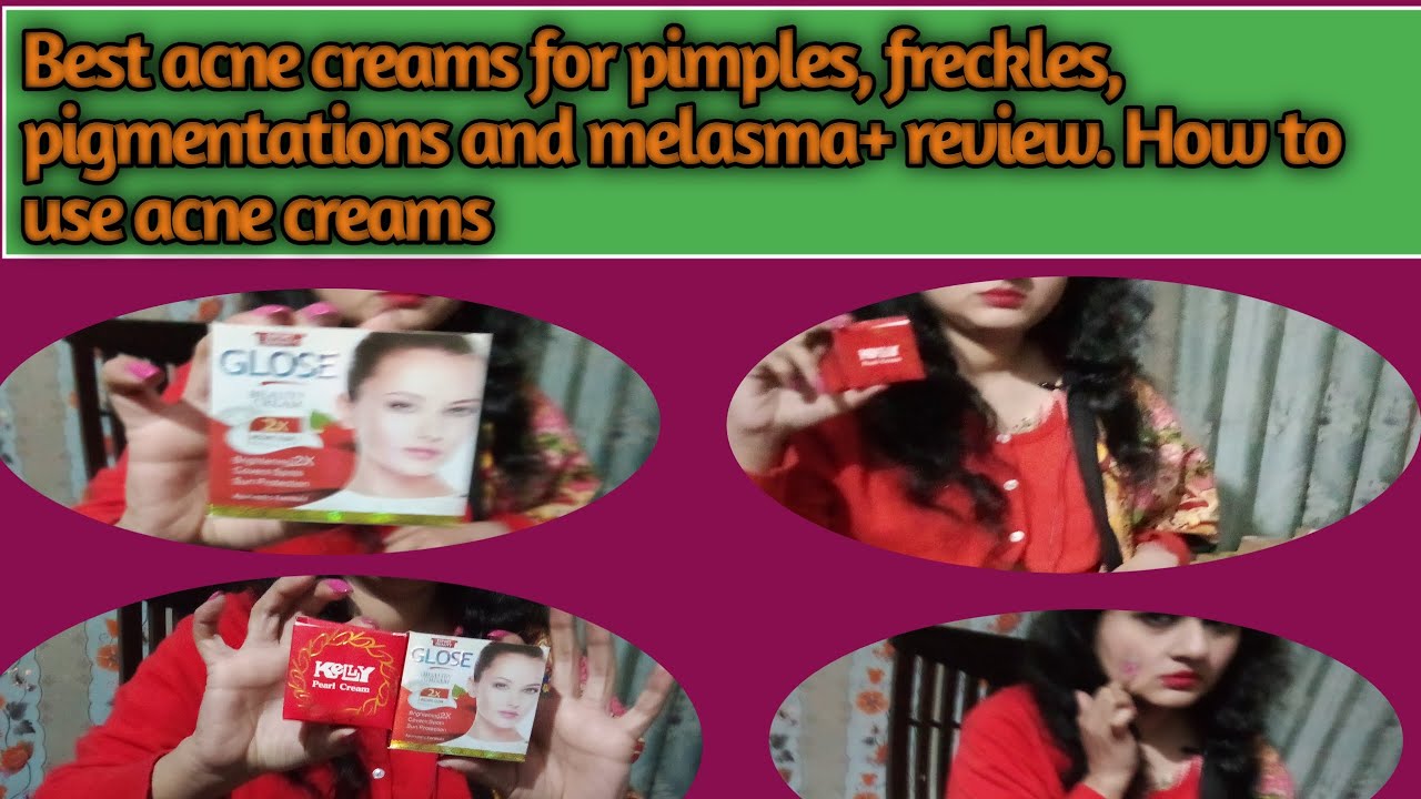 Best acne creams for pimples, freckles, pigmentations and melasma+ ...