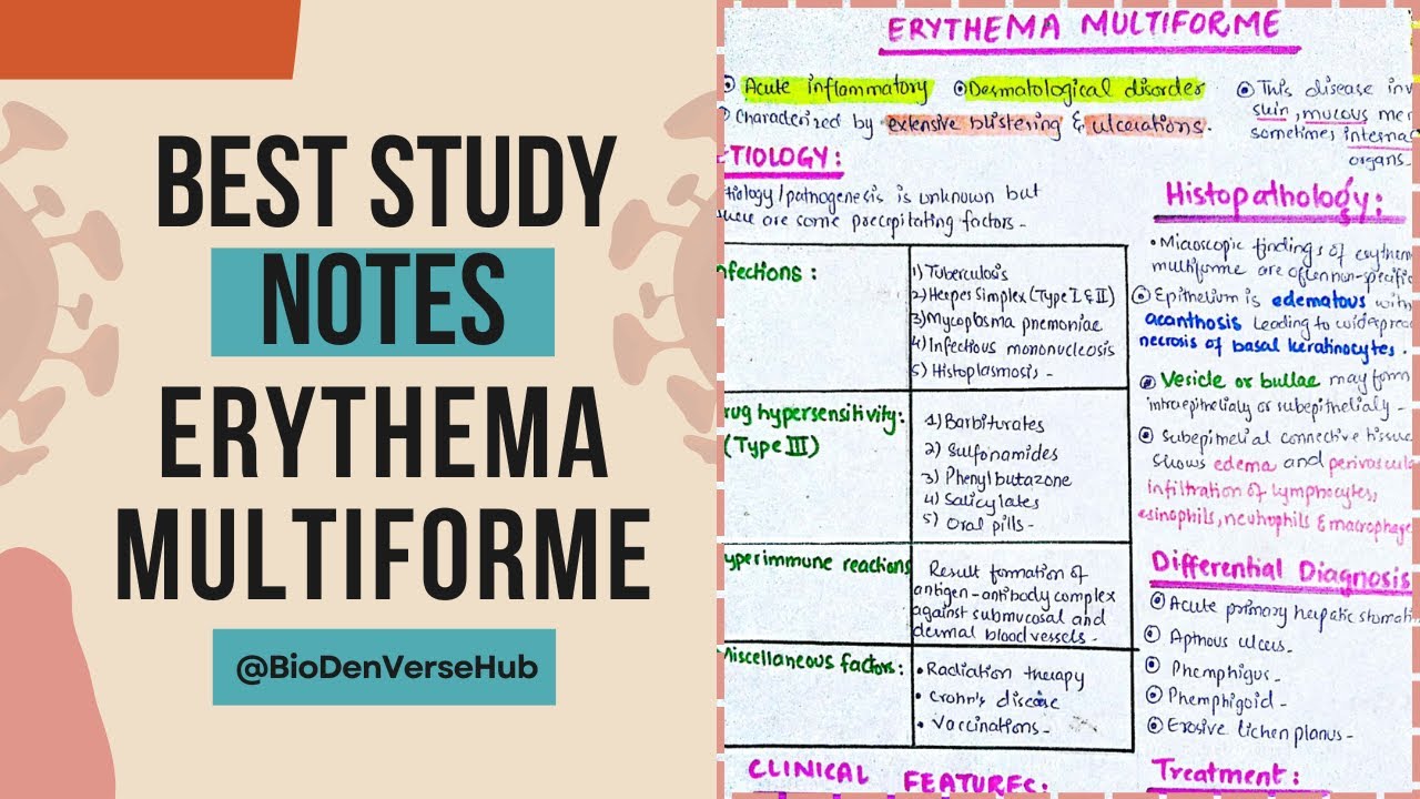 Erythema Multiforme | Oral Ulcerations and Vesiculobullous Diseases ...