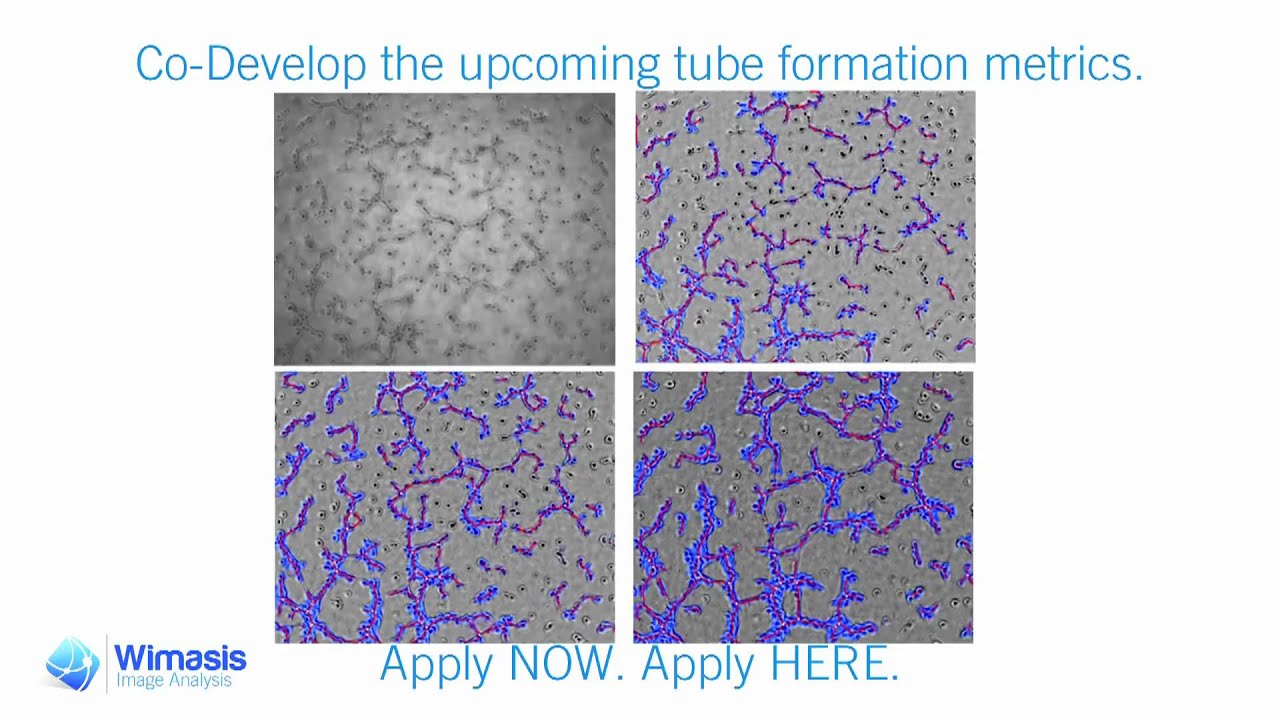 Tube Formation - Co-creation - YouTube
