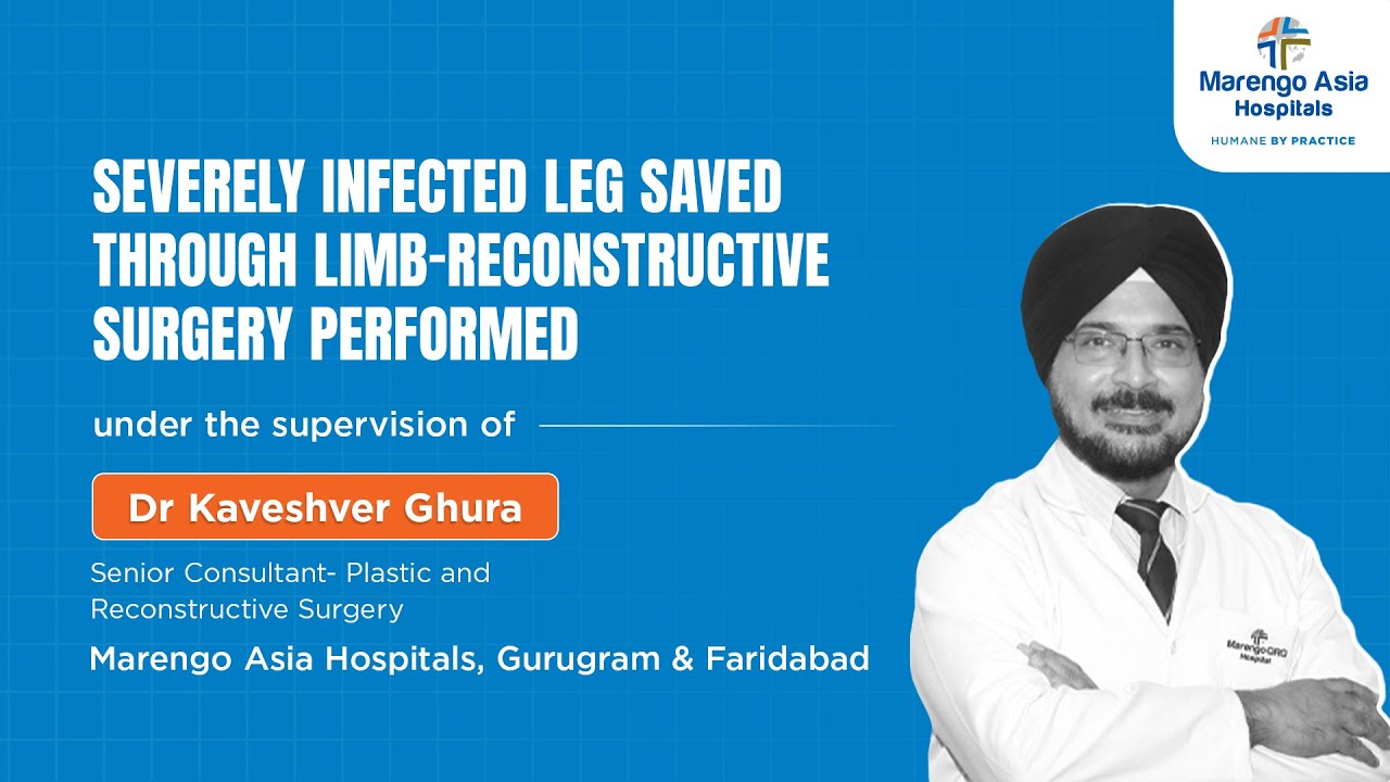 Severely Infected Leg Saved Through Limb-Reconstructive Surgery Under ...