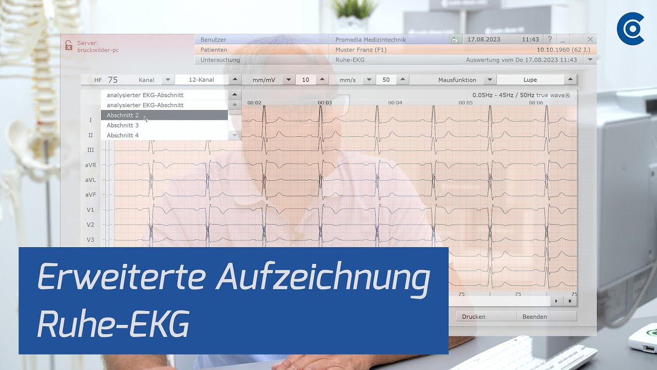 Ruhe-EKG mit der custo diagnostic / Teil 3 erweiterte Aufzeichnung ...