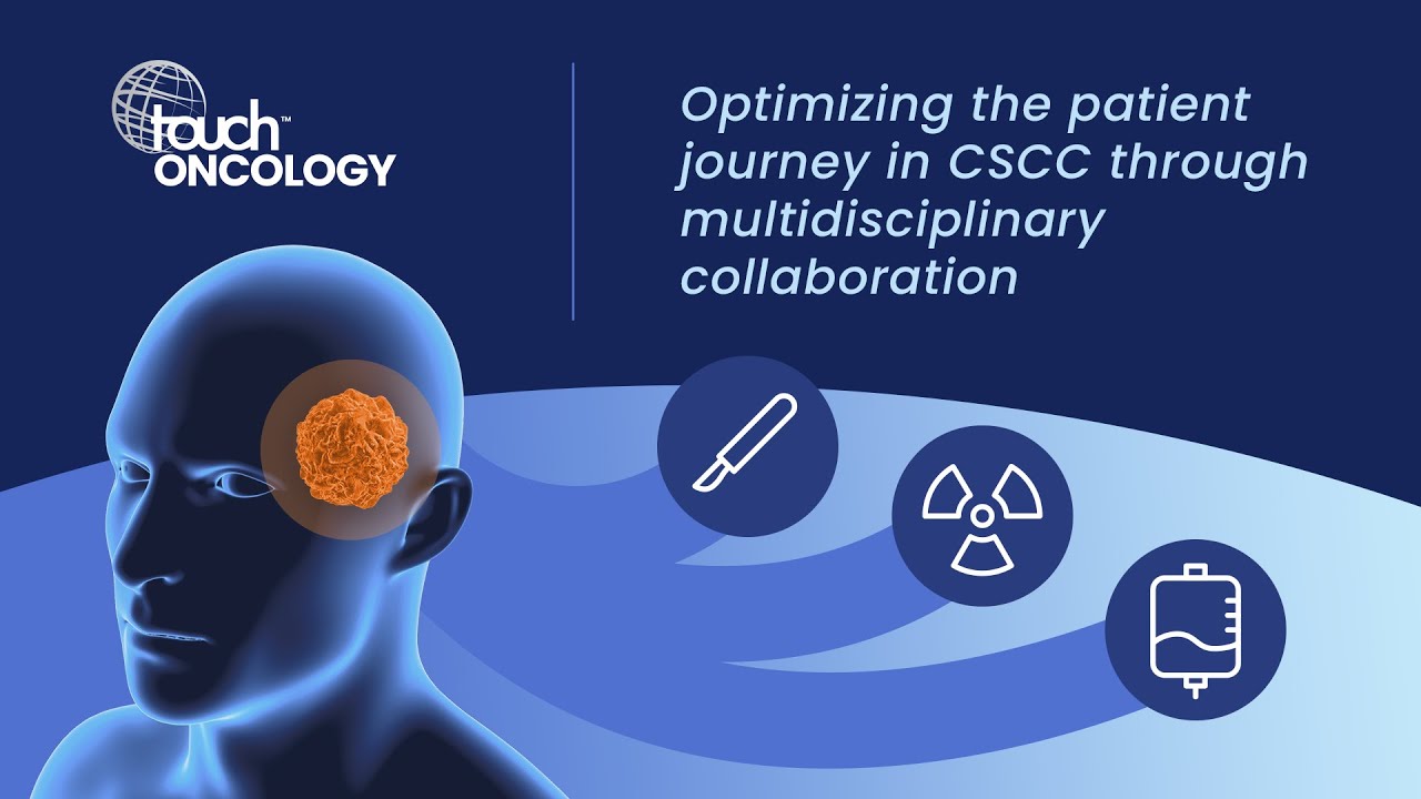 Optimizing the patient journey in CSCC through multidisciplinary ...