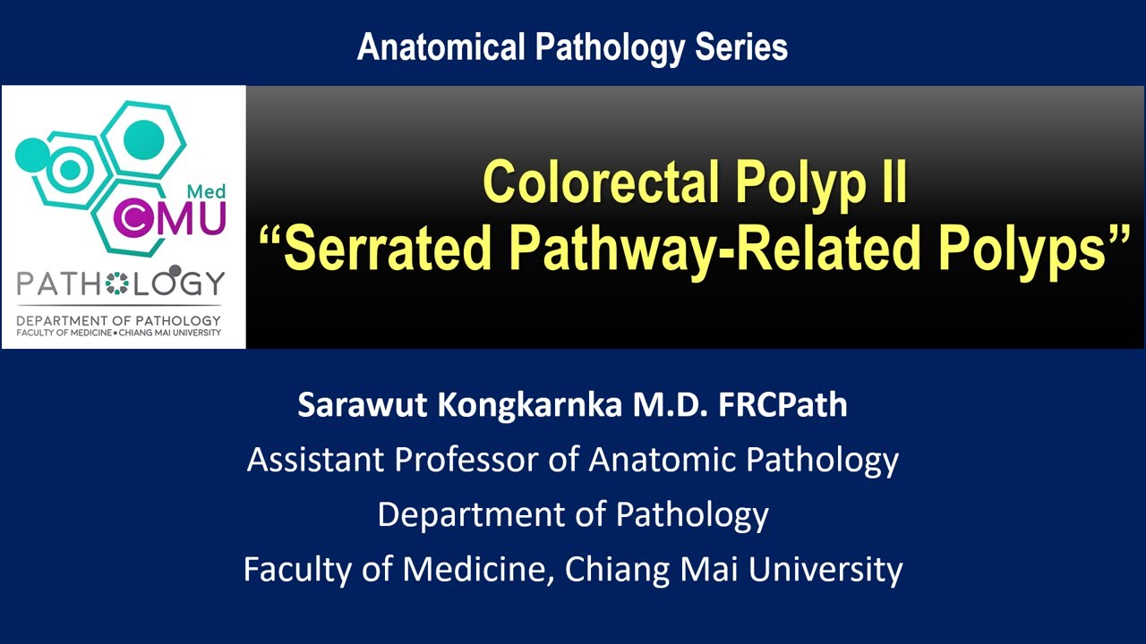 Colorectal Polyp II "Serrated Pathway-Related Polyps" (Dr. Sarawut ...
