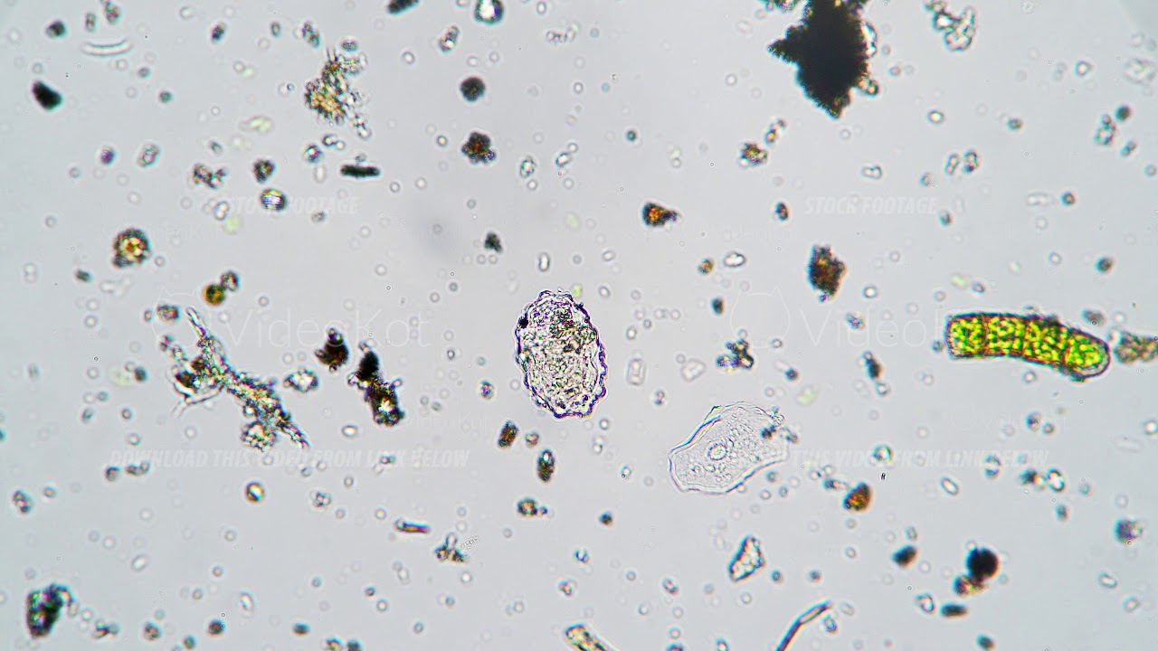 The cyst of the protozoa with alive animal moving inside it under the ...