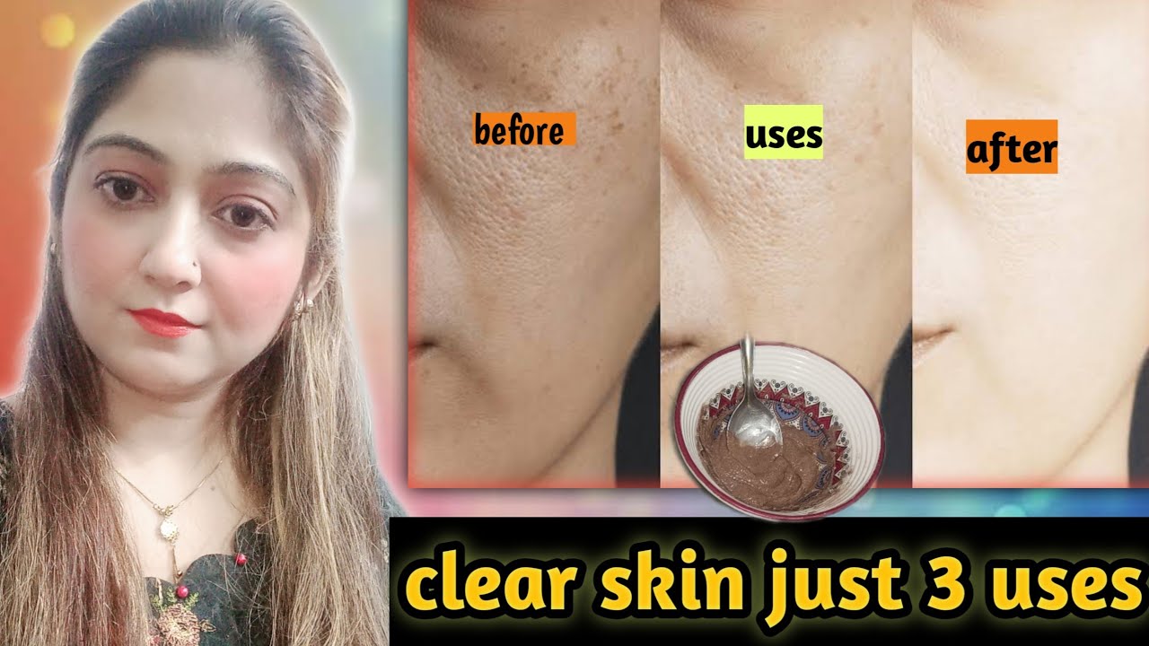 This face pack reduse pigmentation & spots l Gives pink Glowing skin in ...