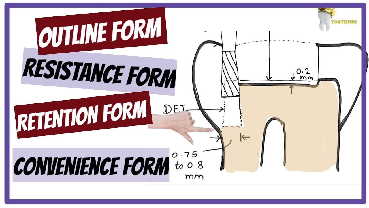 4 Steps of Cavity Preparation MADE SUPER EASY | Tooth Preparation ...