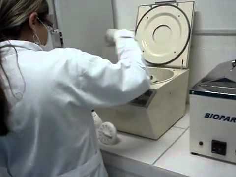 TECNICA URINA   URINALISE wmv   YouTube