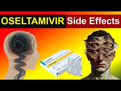 Oseltamivir (Tamiflu) Side Effects: You Should Know