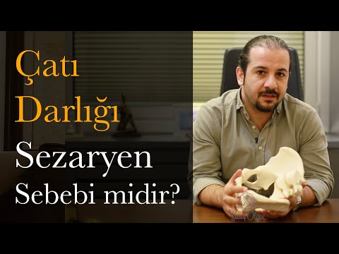 Çatı Darlığı Sezaryen Sebebi midir?