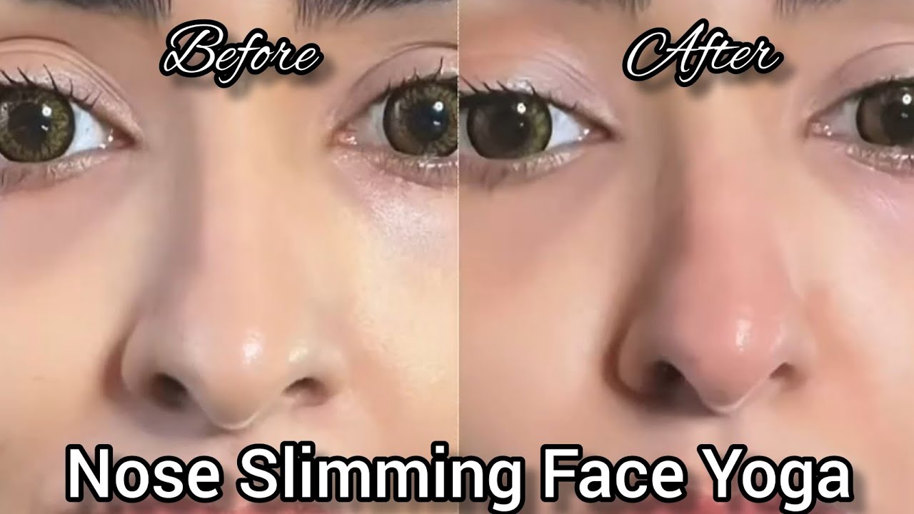 How to Get Slim and Sharp Nose. Nose Reshaping without Surgery. Lose ...