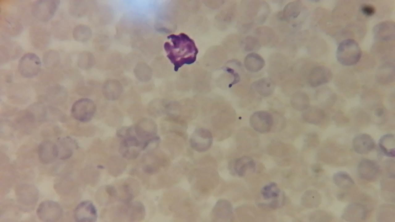 Trypanosoma cruzi :Trypomastigote - YouTube