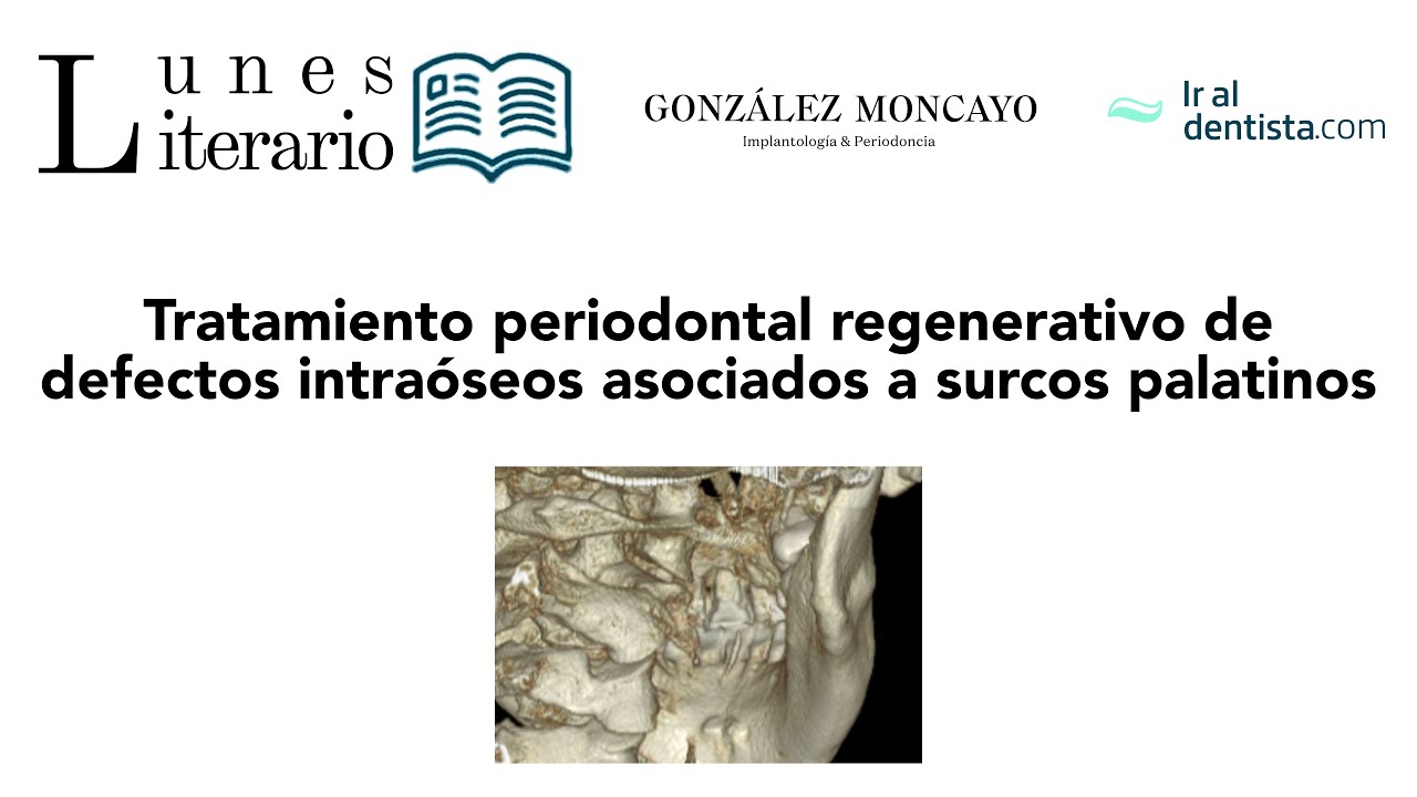 Tratamiento periodontal regenerativo de defectos intraóseos asociados a ...
