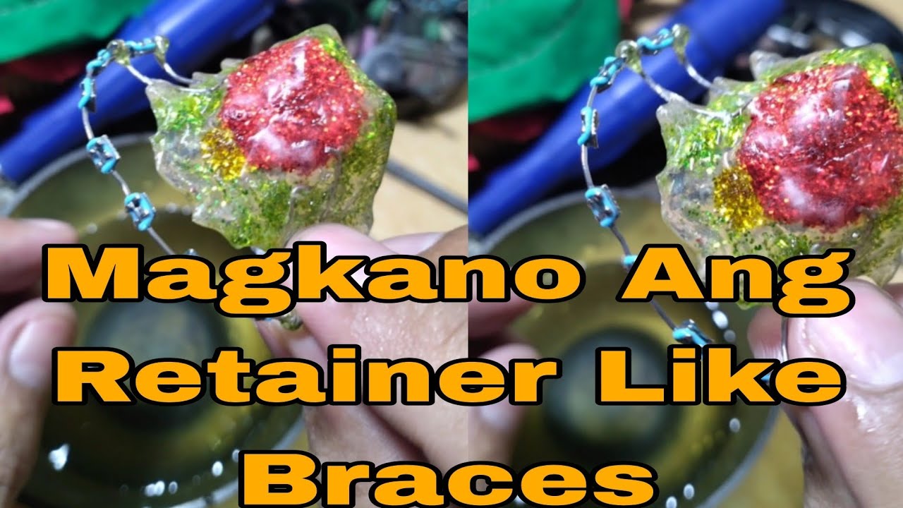 Retainer Like Braces price Philippines. - YouTube