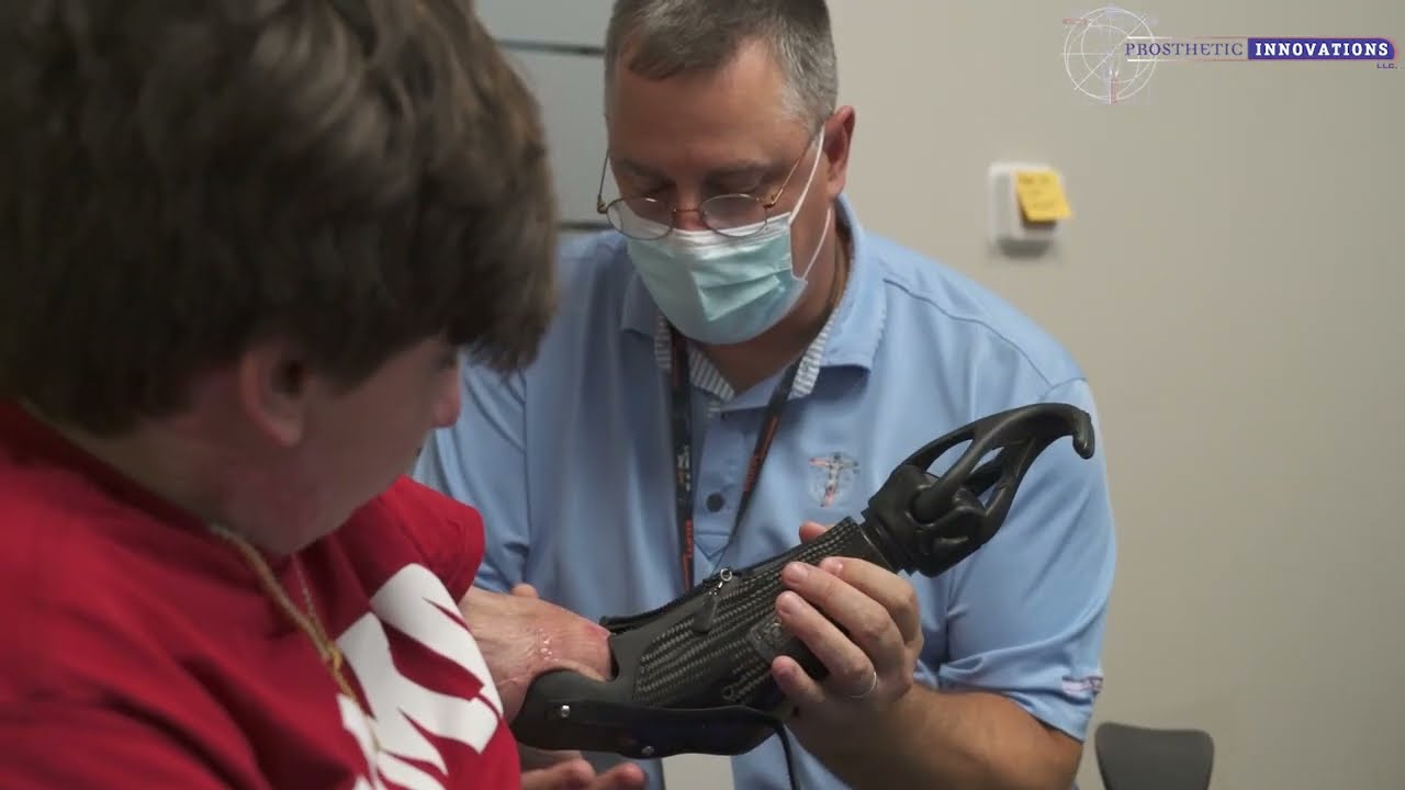 Bilateral Trans-Radial Myo-Electric Prostheses | Greiffer x ETD2 ...