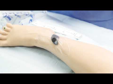 How to apply: 3M™ V.A.C.® Granufoam™ Bridge Dressing - YouTube