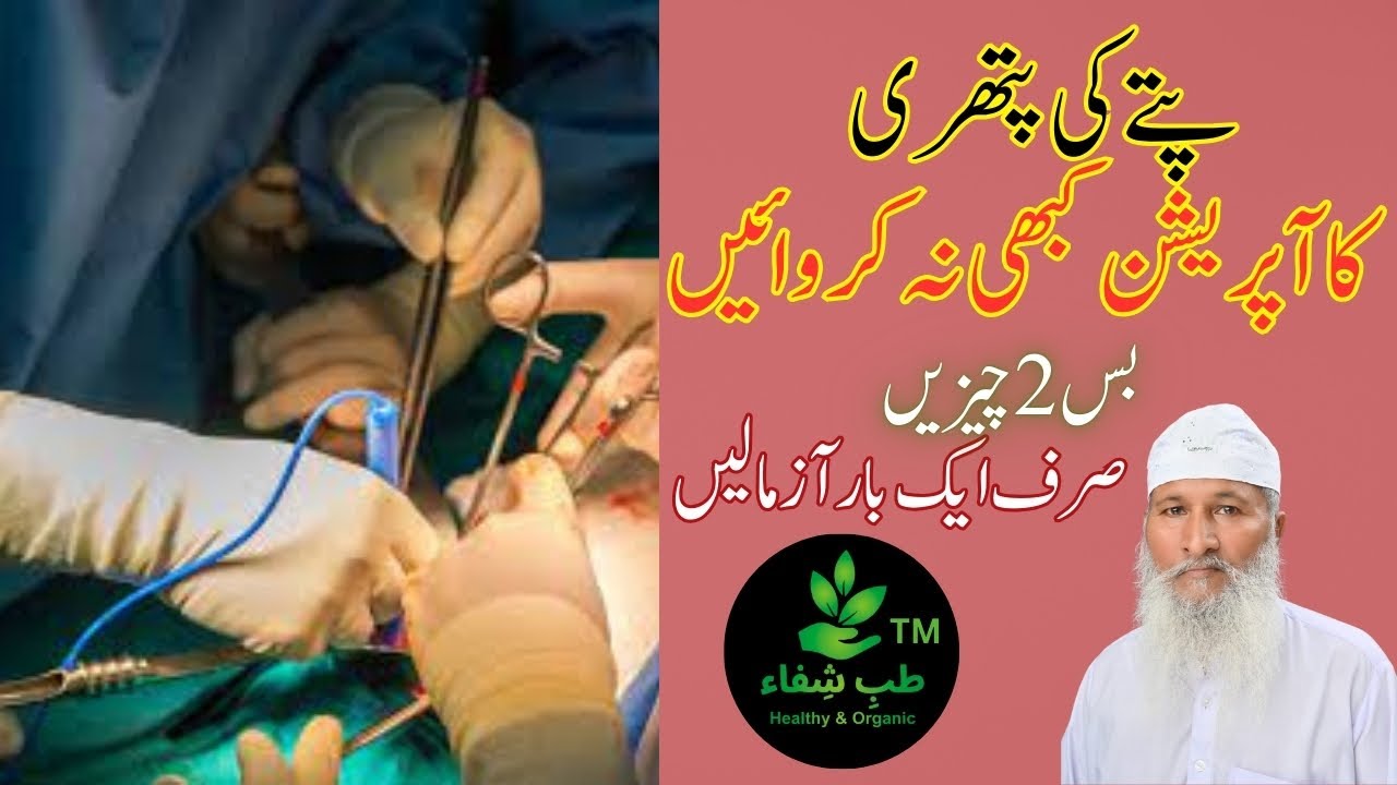 Pitay Me Pathri Ka Ilaj - Gallstones Symptoms And Treatment - Pitte Ki ...