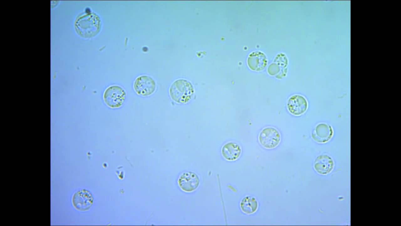 Хлорелла Chlorella vulgaris under microscope - YouTube