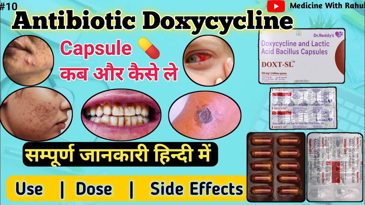 Doxycycline Capsule Ip 100mg || कील-मुहांसे की असरदार दवा || Antibiotic ...