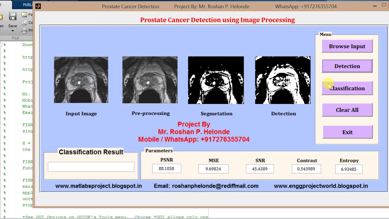 Matlab Code for Prostate Cancer Detection using Image Processing - YouTube
