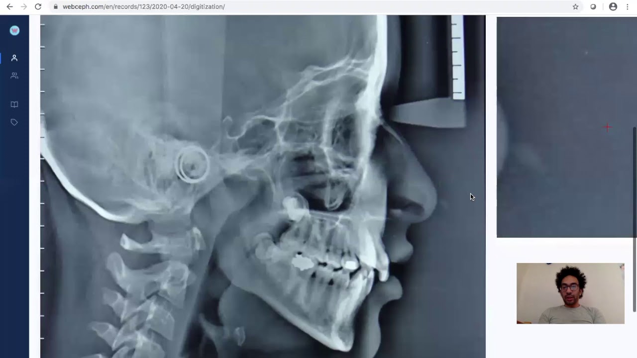 web ceph part 1 - YouTube