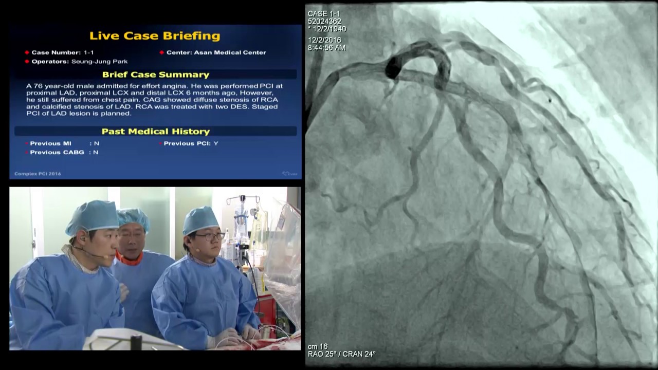 Complex PCI 2016_Live Case Demonstration (1/4) - YouTube