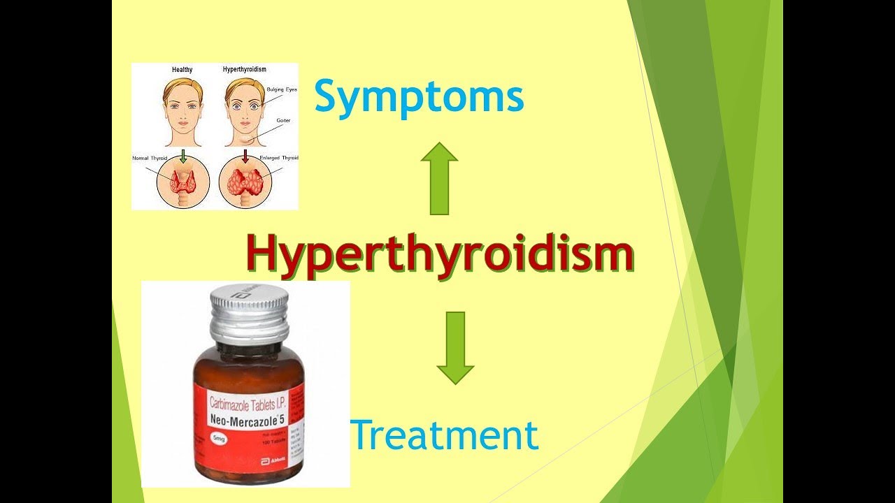 Hyperthyroidism l Symptoms l Treatment l Easy Explanation l Goitre l ...