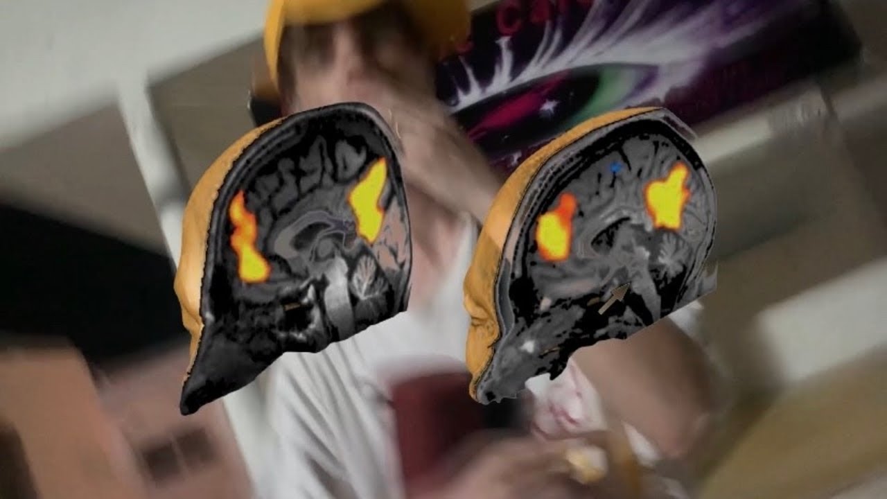 meat computer / beyond saving - YouTube