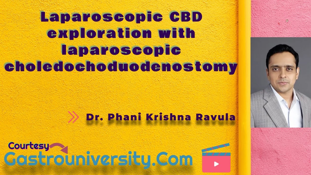 Gall Bladder-Laparoscopic CBD exploration with laparoscopic ...