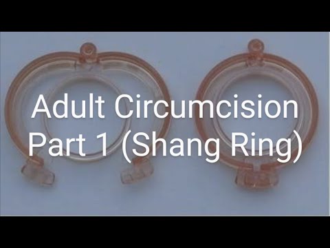 Adult Circumcision Story (Shang Ring) Part 1. - YouTube