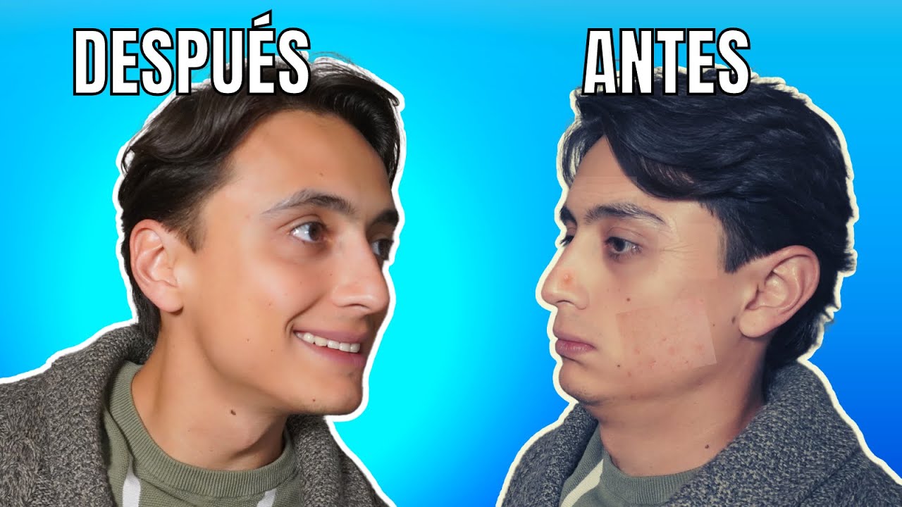 TRUCOS para una cara ATRACTIVA - Cómo ser más GUAPO - YouTube