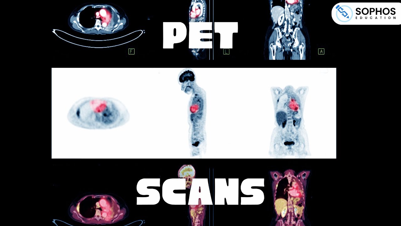PET Scans - YouTube