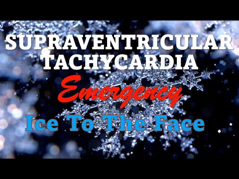 Treating SVT Emergency with Ice to the Face - YouTube