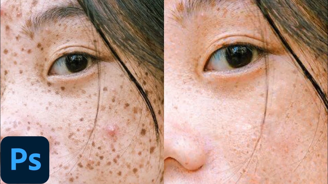 Learn easy way of retouching skin retaining skin texture with patch ...