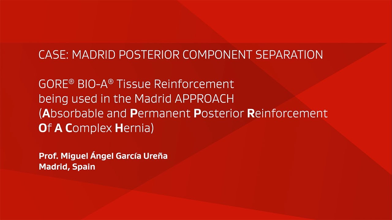 Madrid posterior component separation technique - YouTube