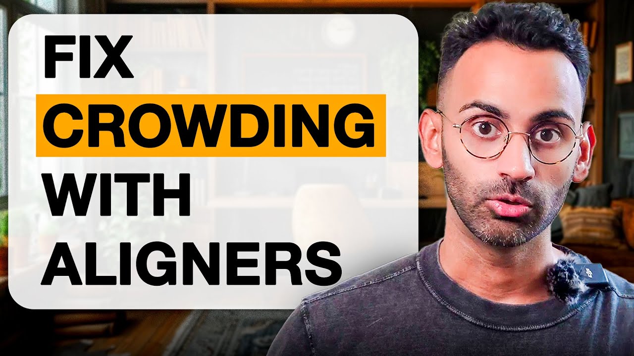 How To Solve Crowding with Aligners: 4 Ways To Treat - YouTube