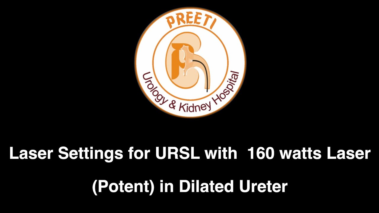 Laser Settings for URSL with (160 watts Laser ( Potent) in Dilated ...
