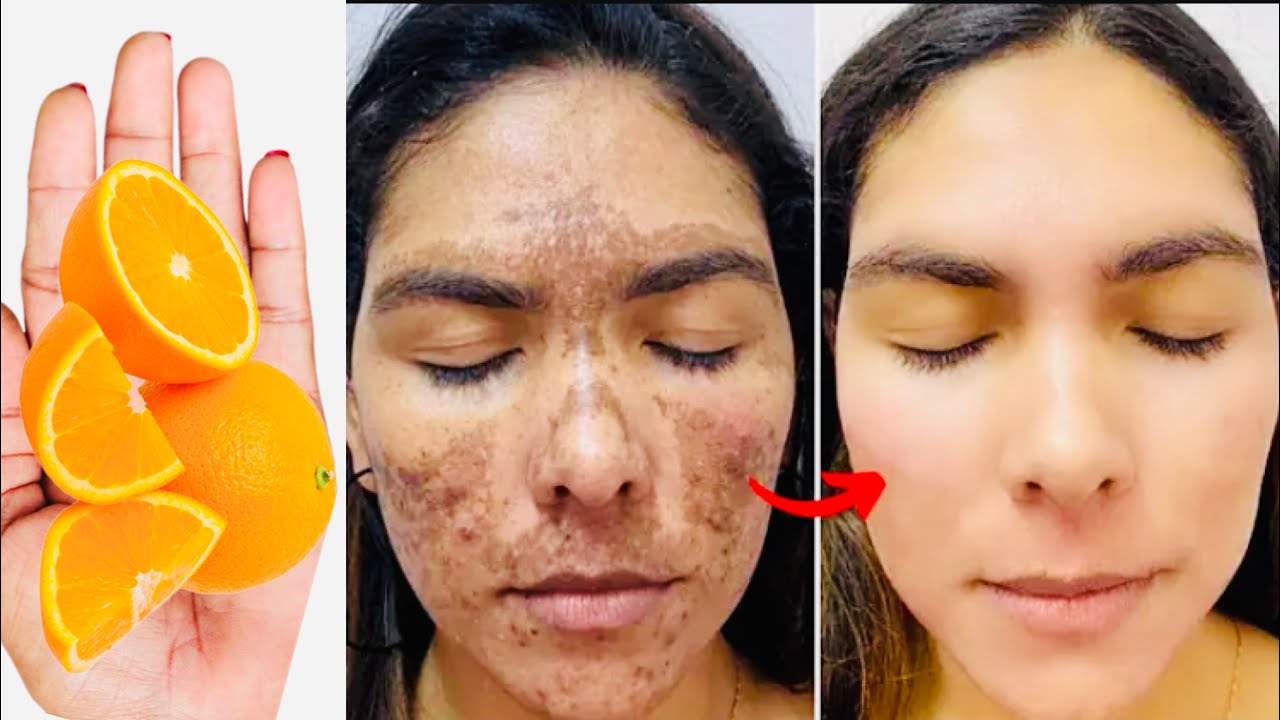 How To Make Orange Face Pack At Home #Beautyideas #skinwhitening # ...