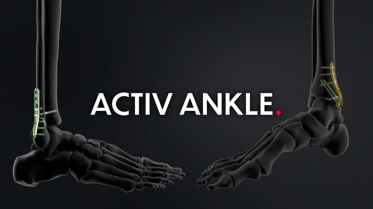 Activ Ankle range - Management of ankle fractures & osteotomies - YouTube