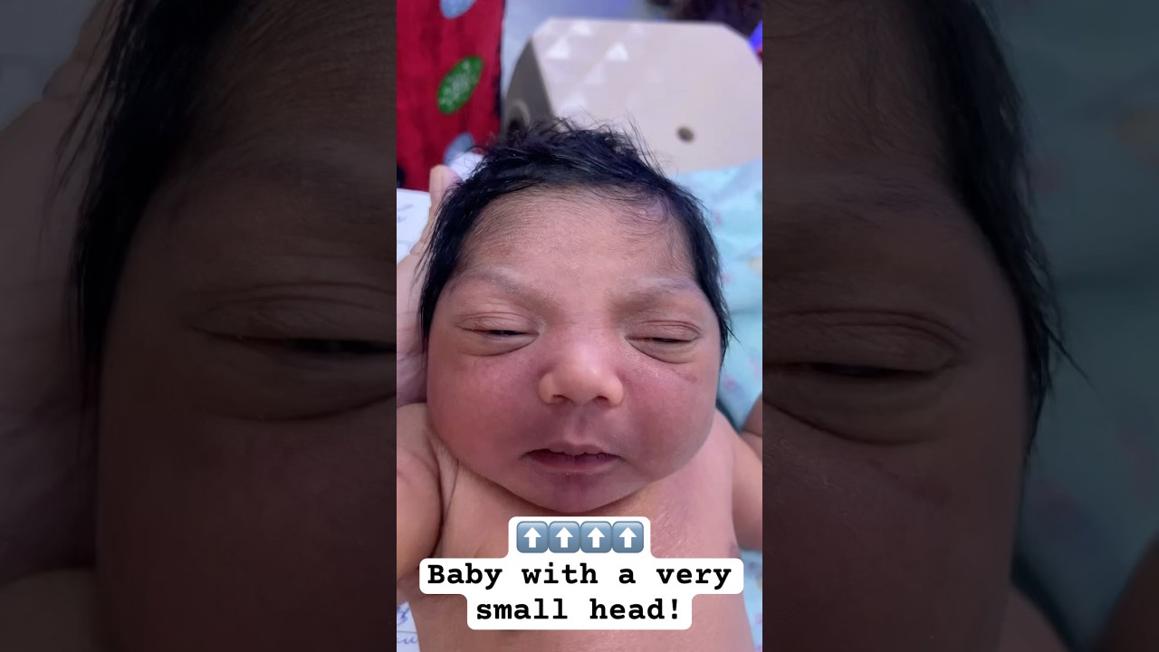 SMALL HEAD USUALLY MEANS SMALLER BRAIN VOLUME. #cutebaby #mom #pregnancy #drsyedazher # ...