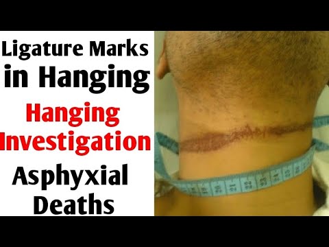 Ligature Marks || Different types of Ligature Marks in Case of Hanging ...