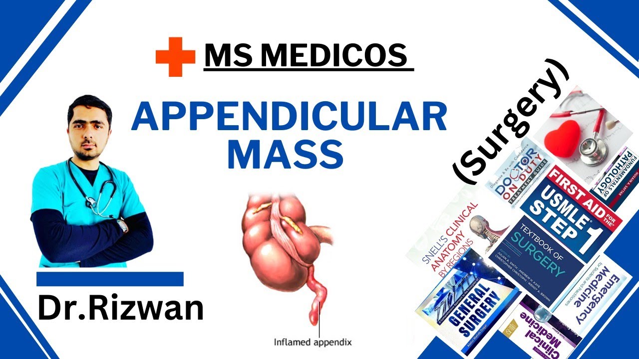 Acute Appendicitis Lecture Part 4 | Appendicular Mass: Diagnosis ...