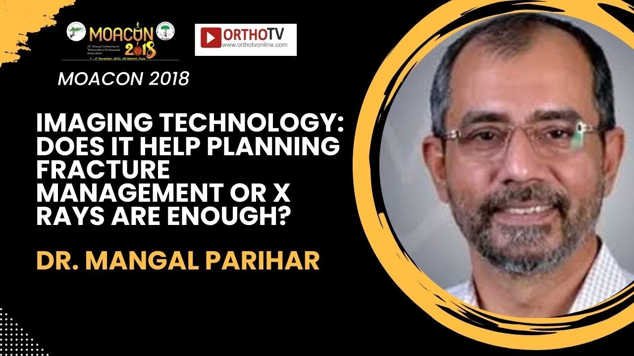 MOACON 2018: Imaging Tech in Fracture Management: Is X-ray Enough? - Dr ...