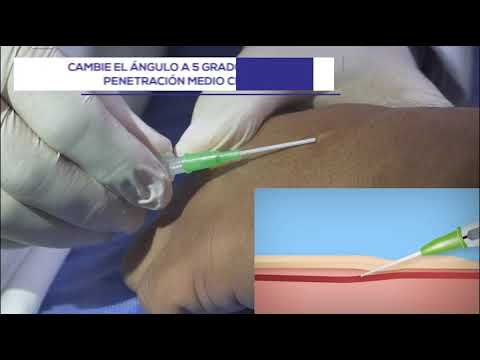 TÈCNICA DE VENOPUNCIÒN - YouTube