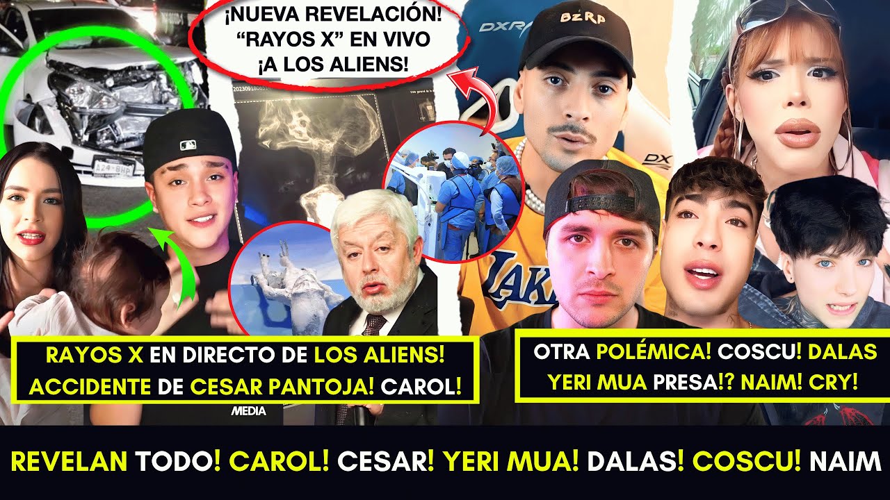 ACCIDENTE captado! ALIEN en RAYOS X! COSCU furioso! DALAS! CESAR ...
