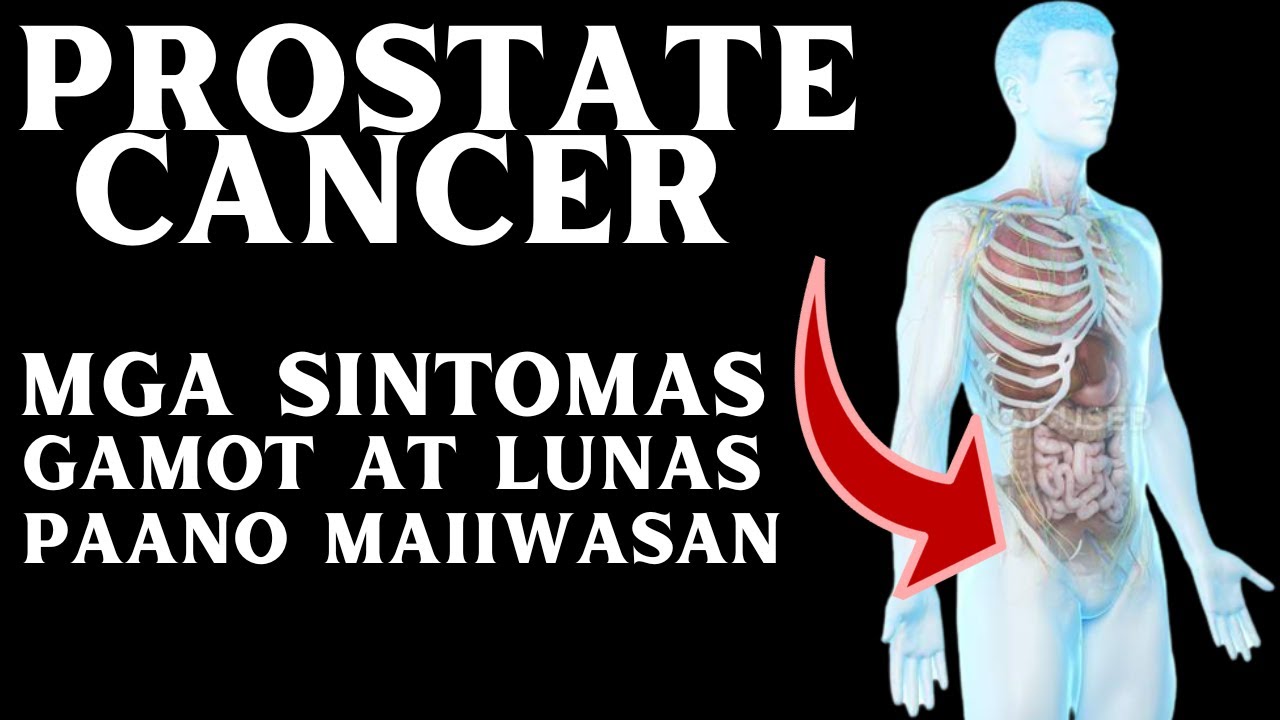 11 Sintomas ng PROSTATE CANCER | Mga SANHI, SENYALES, Gamot at paano ...