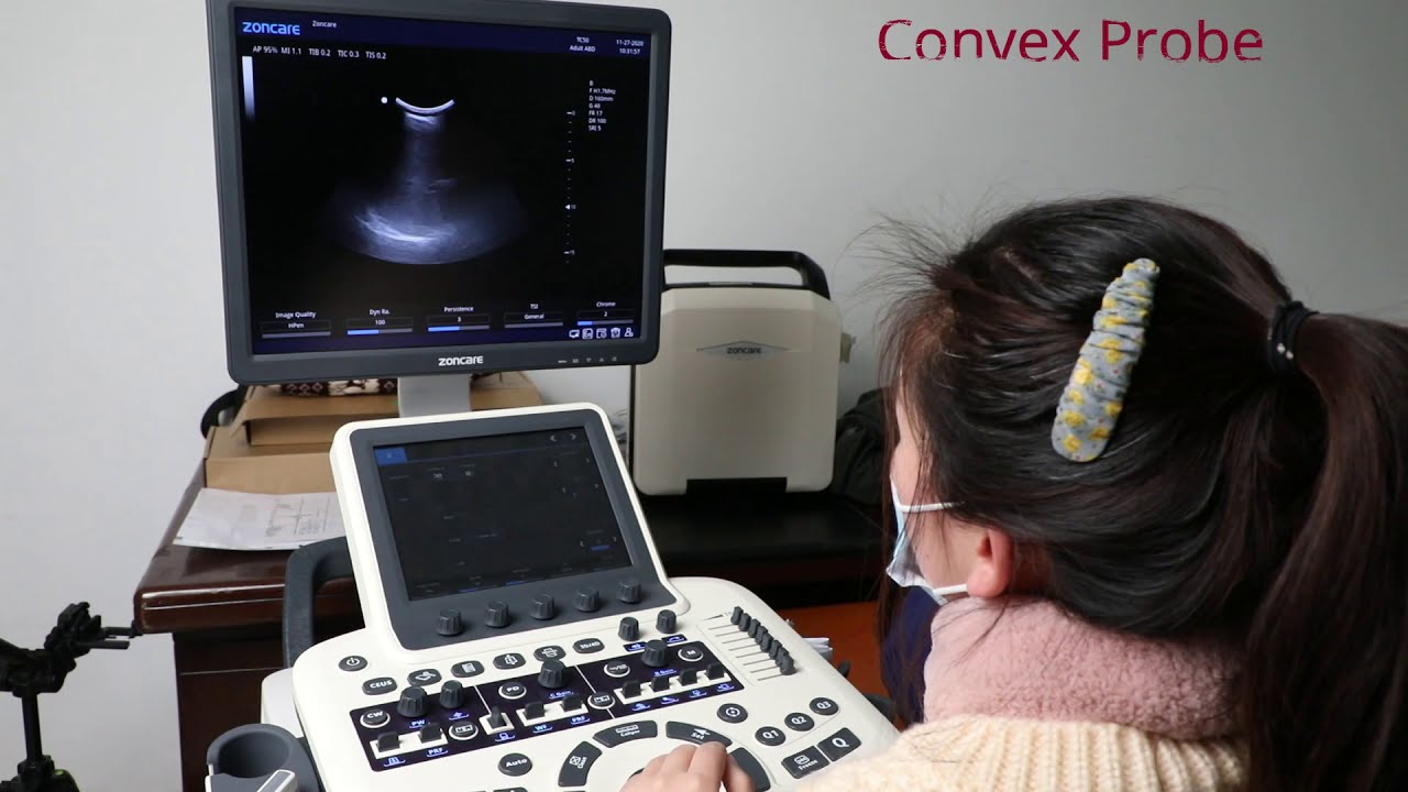 zoncare Ultrasound machine N7 - YouTube