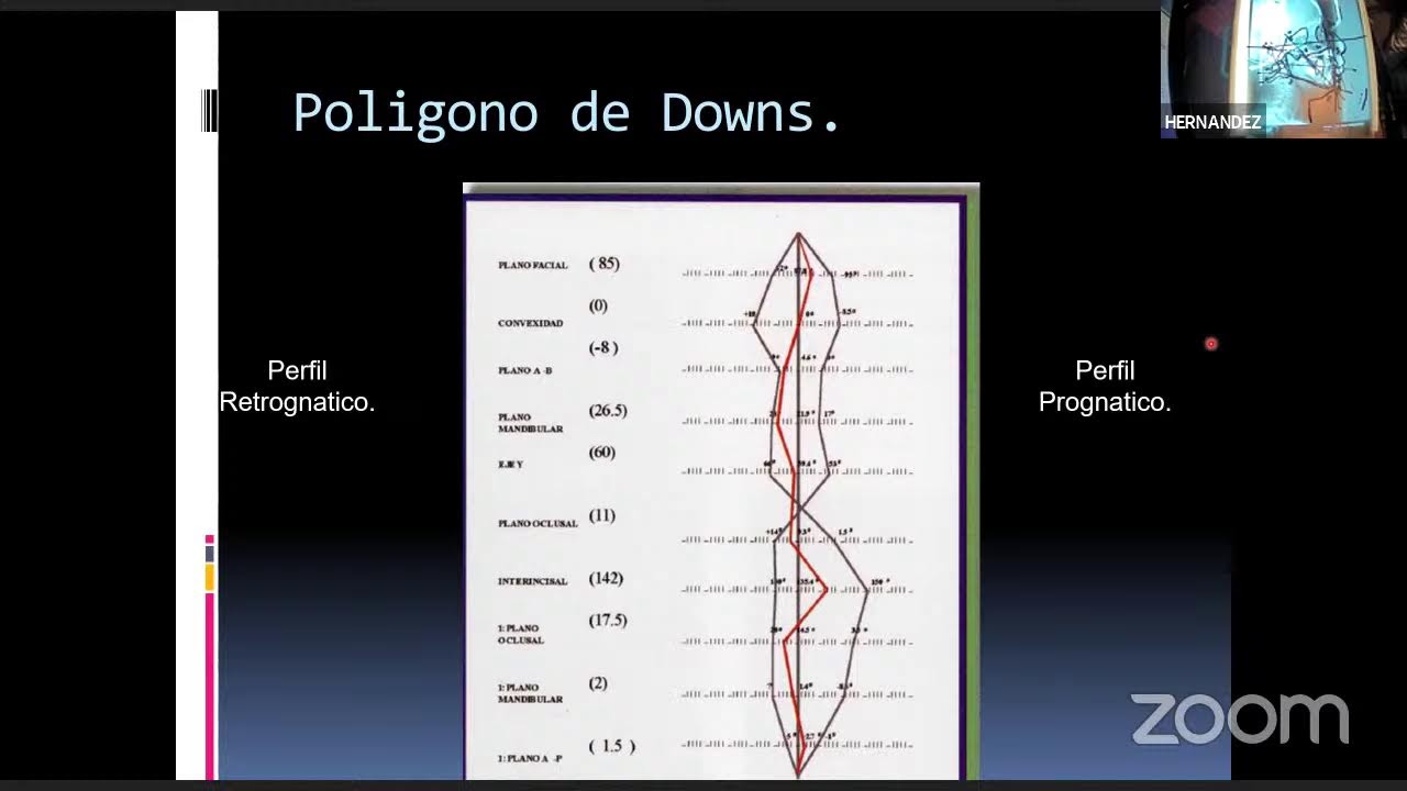 Trazado Analisis de Downs - YouTube
