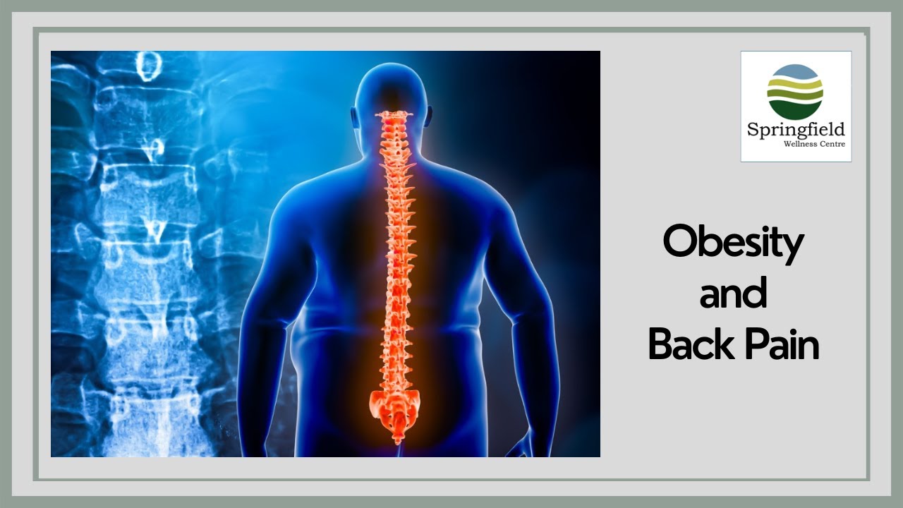 Obesity and Back Pain | Dr Maran on the connection between Obesity and ...