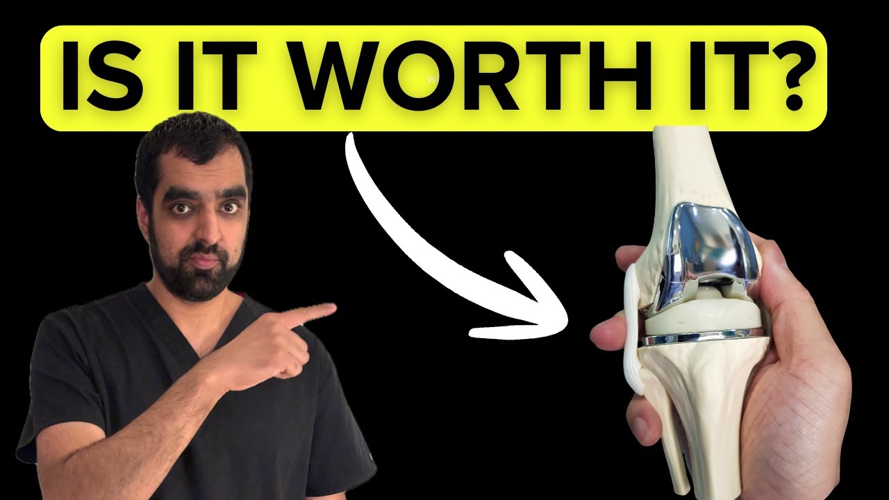 Will Your Knee Replacement LAST- And Will You Be HAPPY With It? - YouTube